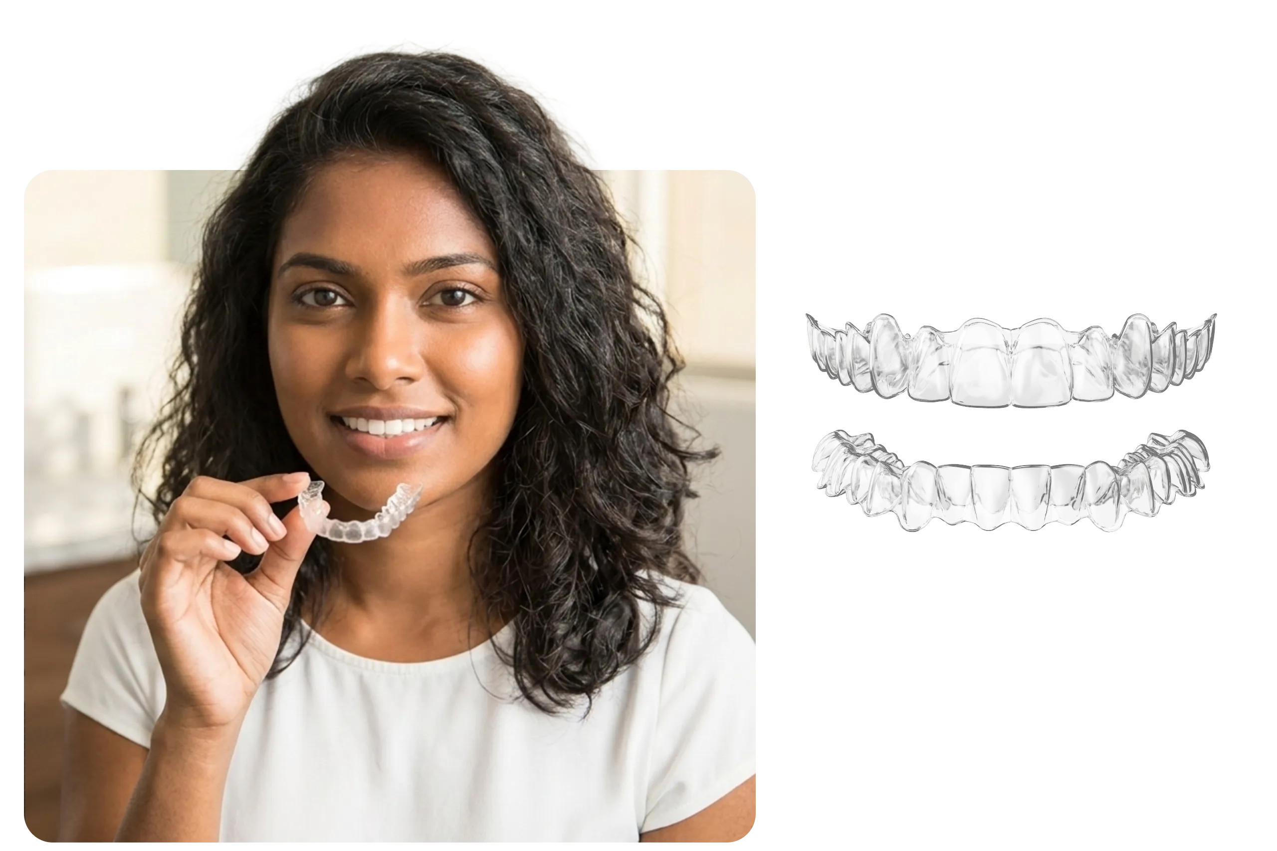 Clear Aligner Price in Sri Lanka - Cayo Dental Hospital